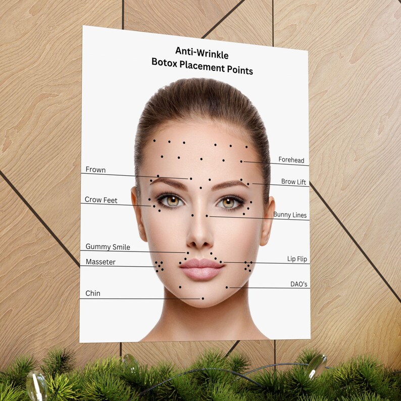 Customized With Logo Anti-wrinkle Botox Placement Points Poster, Medspa ...
