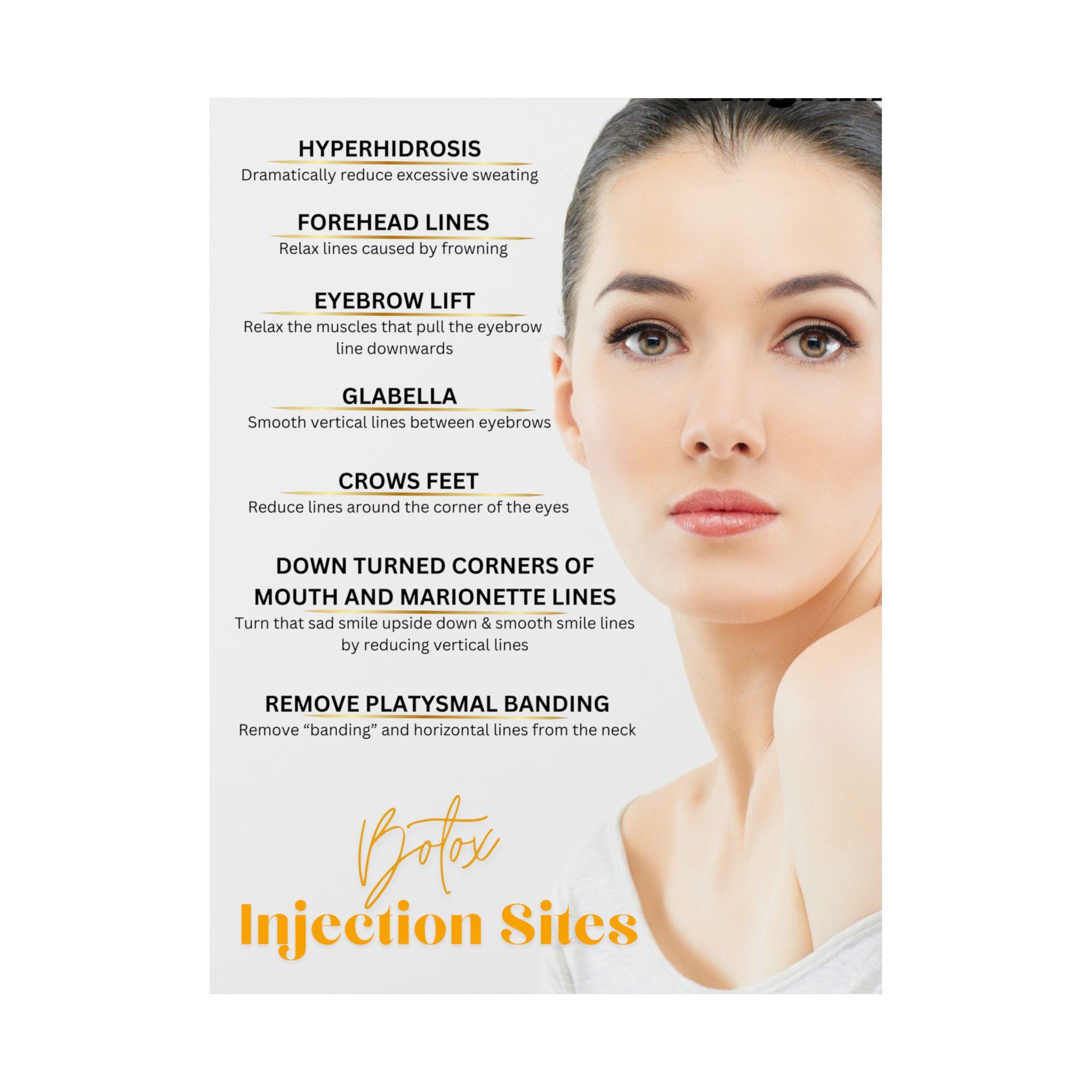 Botox Injection Sites Poster, Botox Benefits Esthetician Consultation ...