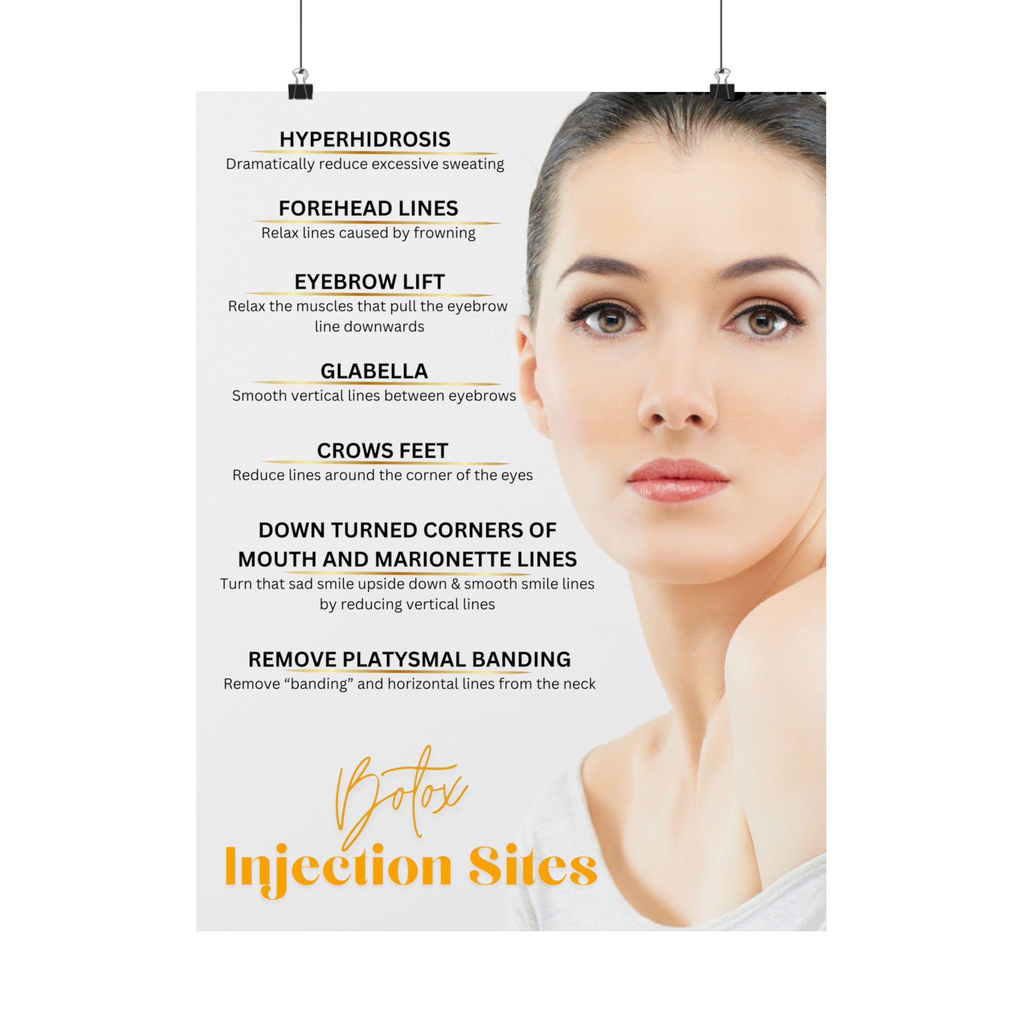 Botox Injection Sites Poster, Botox Benefits Esthetician Consultation ...