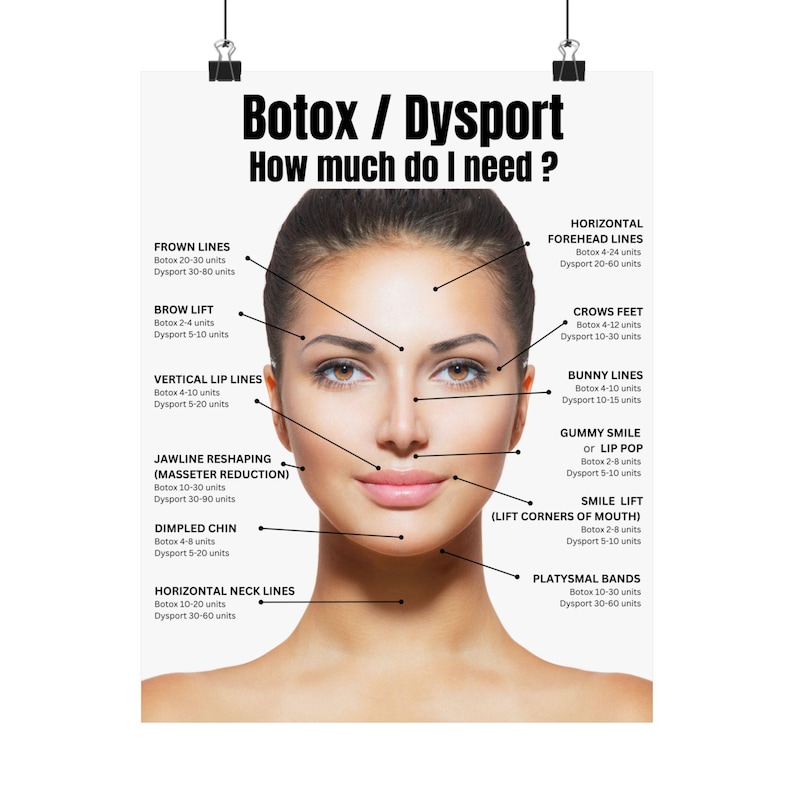 Customizable Botox Dysport How Much Do I Need Poster, Esthetician Consultation Tool, Medspa ...