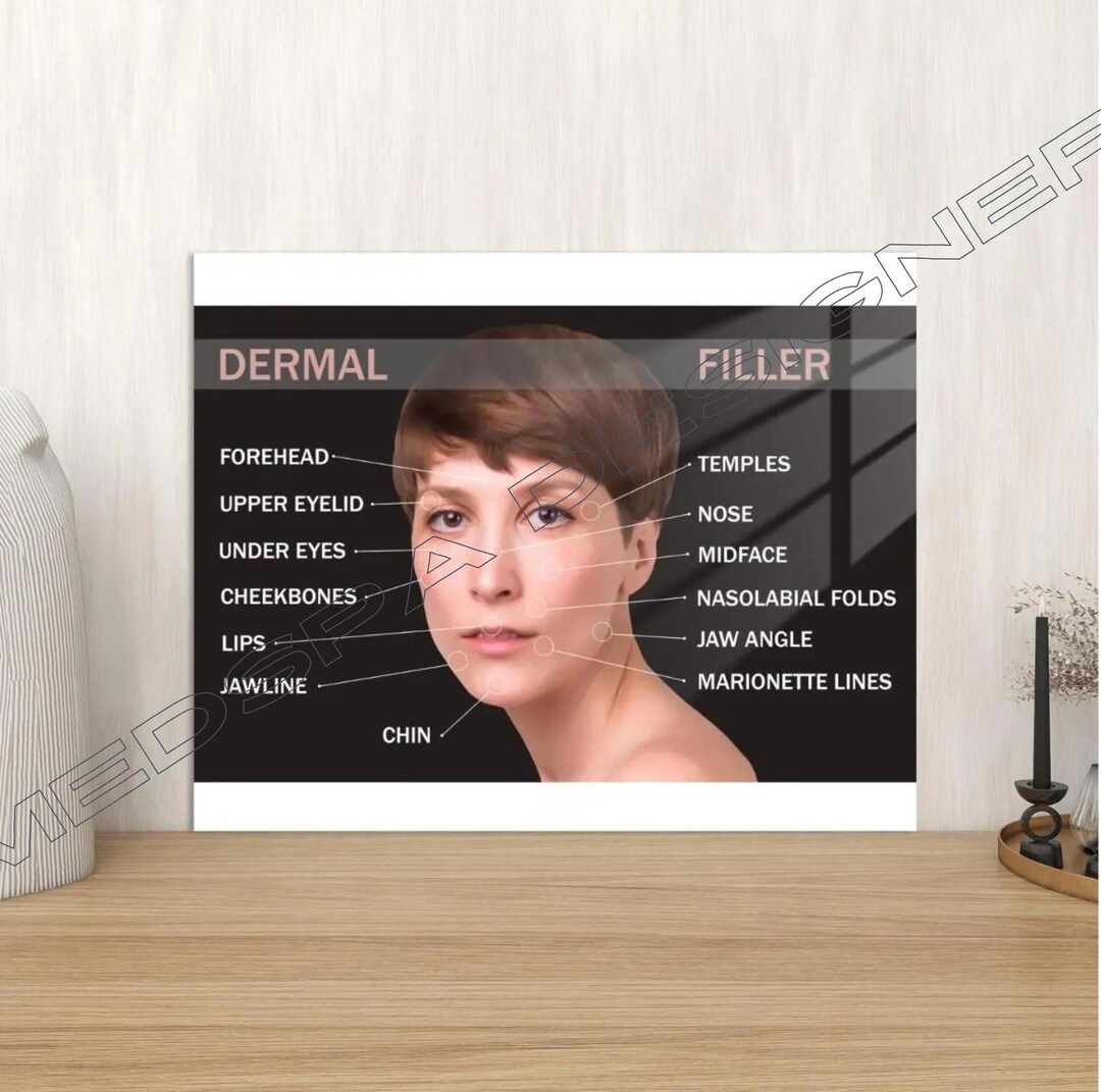 Dermal Filler Placement Area Acrylic Prints, Medspa Wall Decor ...