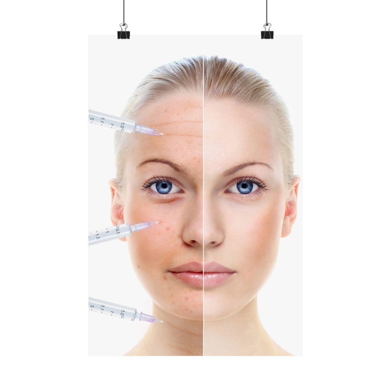 Botox Treatment Before and After Matte Vertical Poster, Medspa Nurse ...