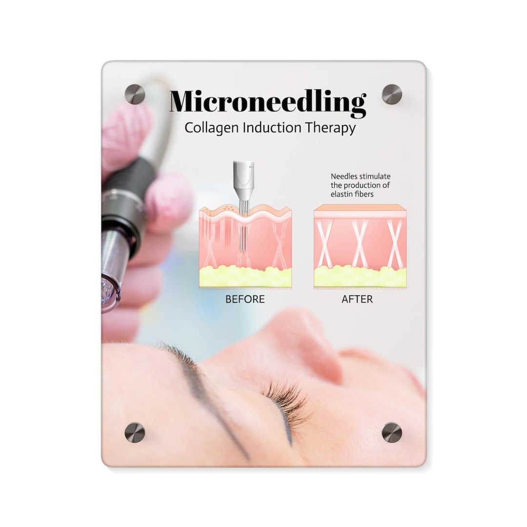 Microneedling Collagen Induction Therapy Acrylic Board, Nurse Injector ...