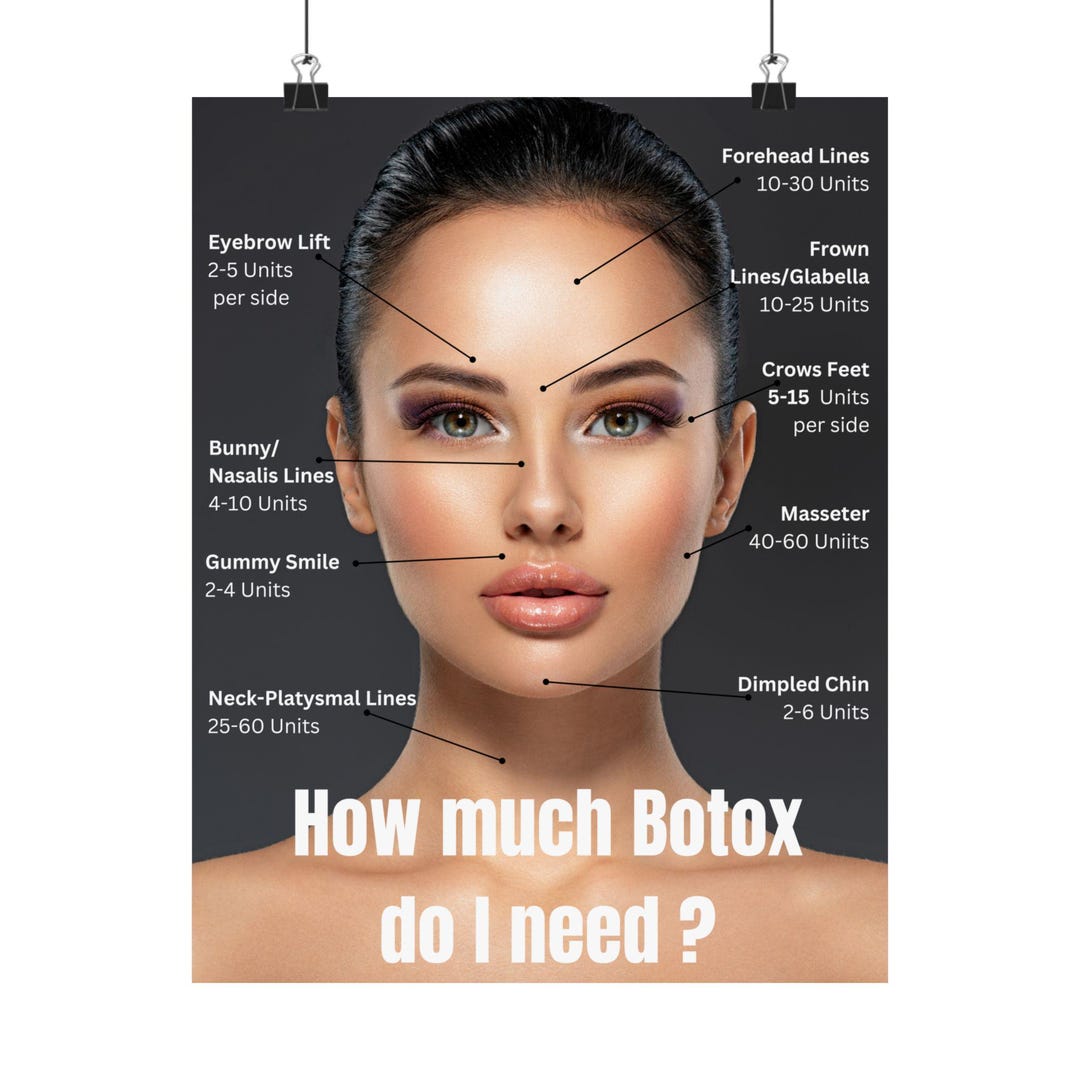 Customizable How Much Botox Do I Need Poster, Esthetician Consultation ...