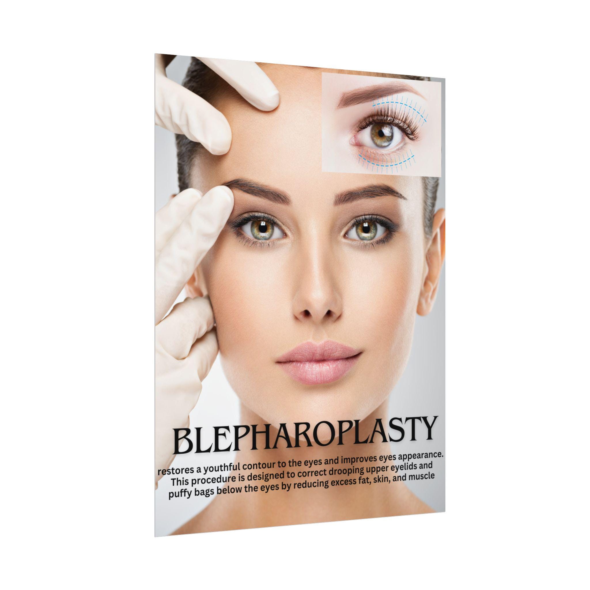 Blepharoplasty (eyelid Surgery) Rolled Poster, Face Lift Med Spa Poster ...