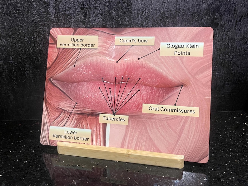 Facial and Lips Anatomy Nurse Injector Medspa Consultation Board ...