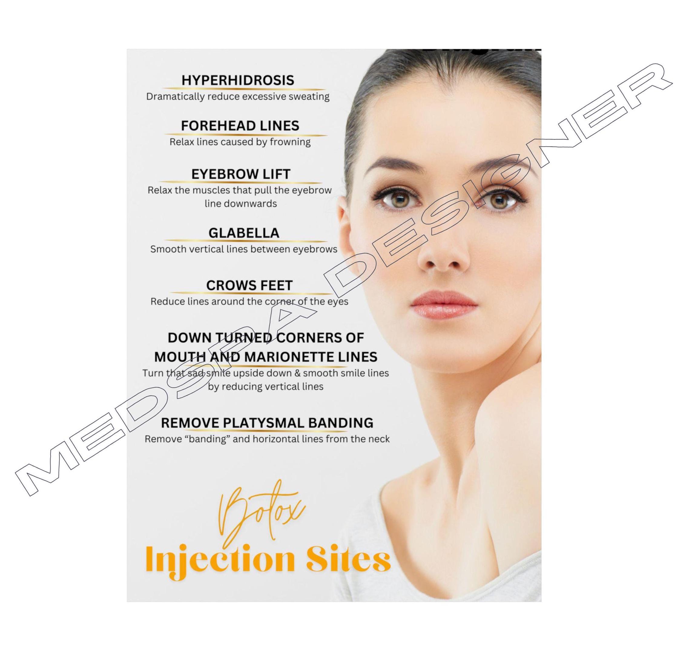 Botox Injection Sites Poster, Botox Benefits Esthetician Consultation ...