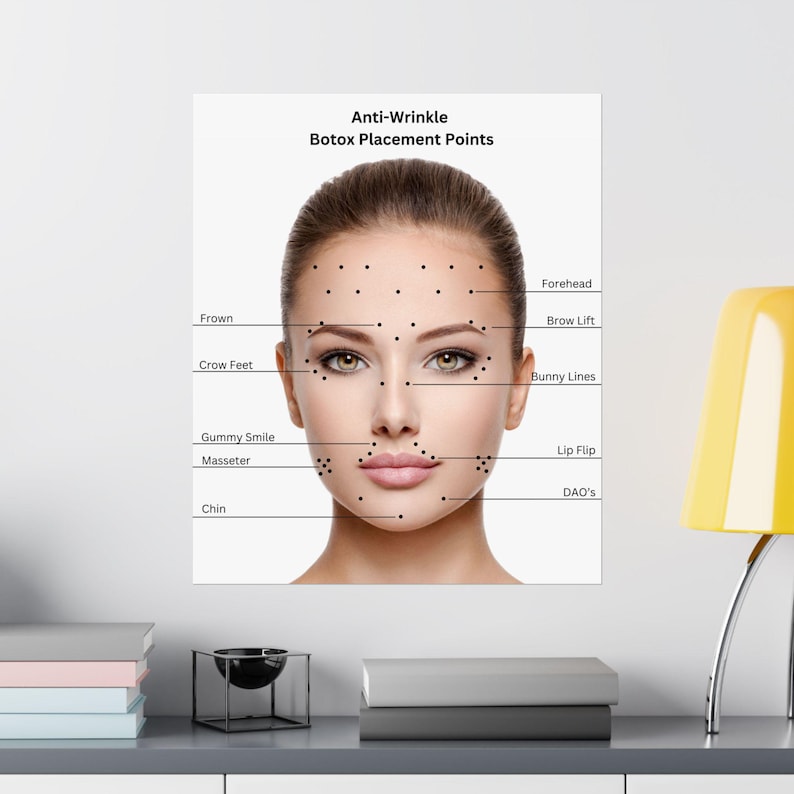 Customized With Logo Anti-wrinkle Botox Placement Points Poster, Medspa ...