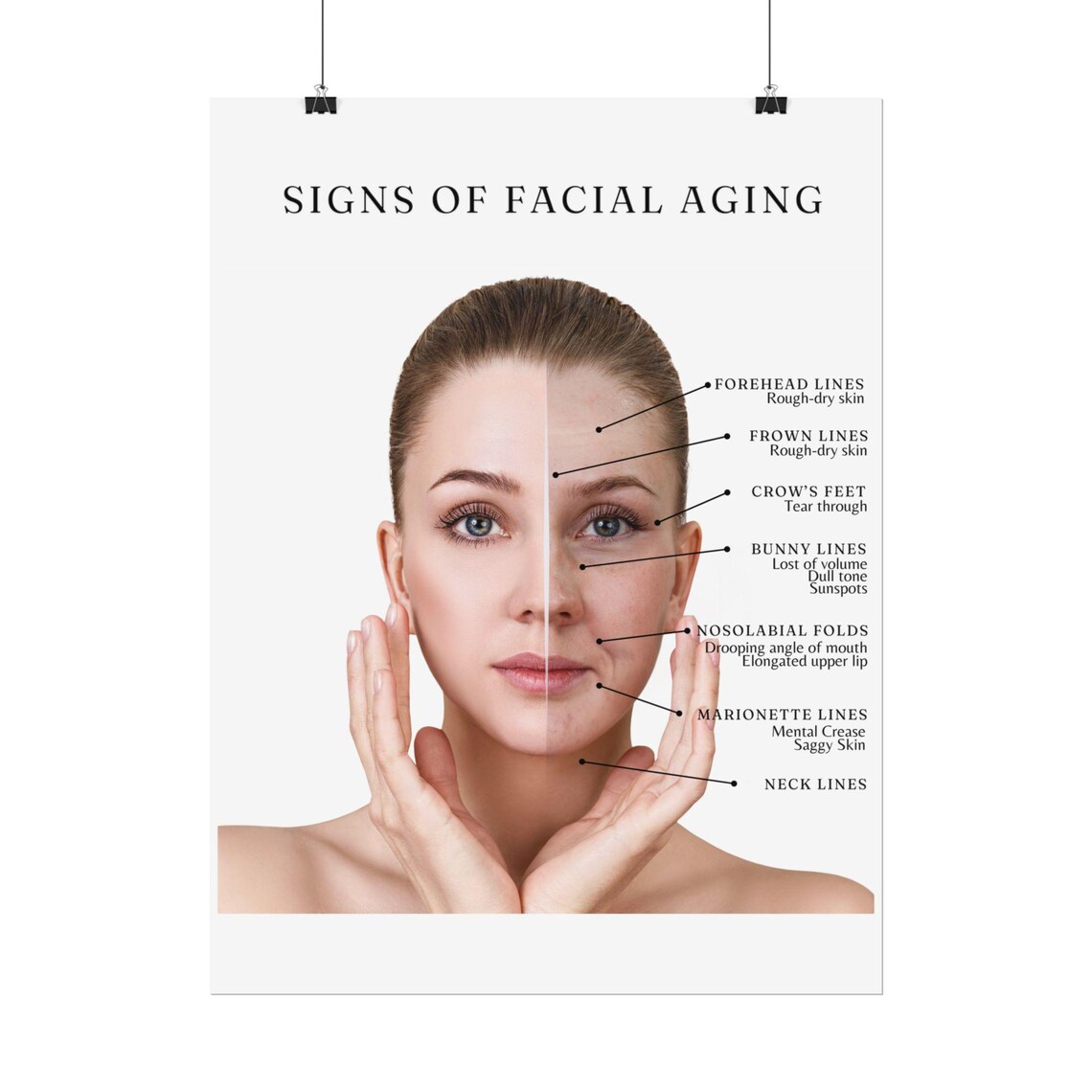Signs of Facial Aging Rolled Poster, Med Spa Poster, Esthetician Wall ...