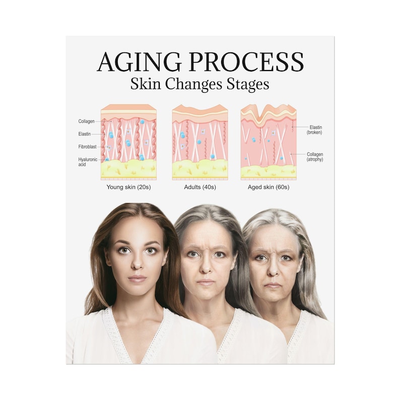 Aging Process Skin Changes Stages Rolled Poster, Face Lift Med Spa ...