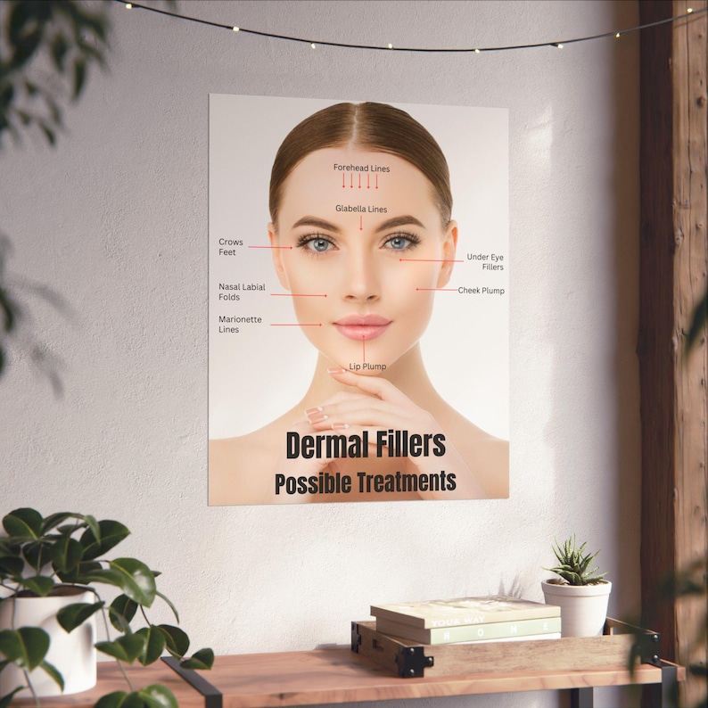Dermal Filler Possible Treatments Poster, Medspa Nurse Injector Decor ...