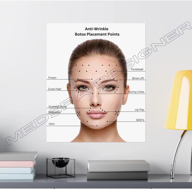 Customized With Logo Anti-wrinkle Botox Placement Points Poster, Medspa ...