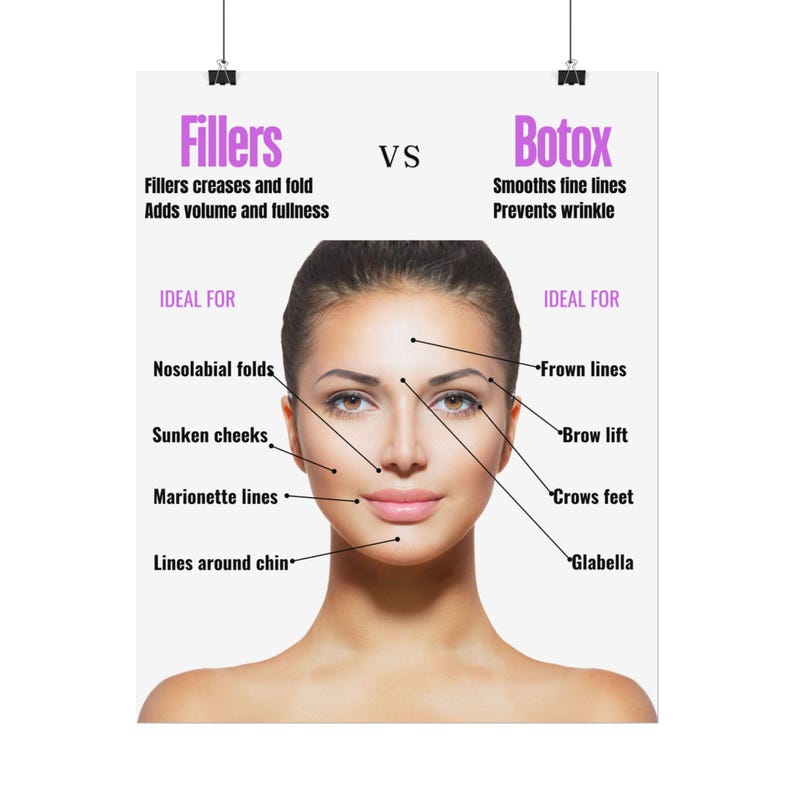 Botox Vs Filler Rolled Poster, Med Spa Poster, Esthetician Wall Art - Etsy