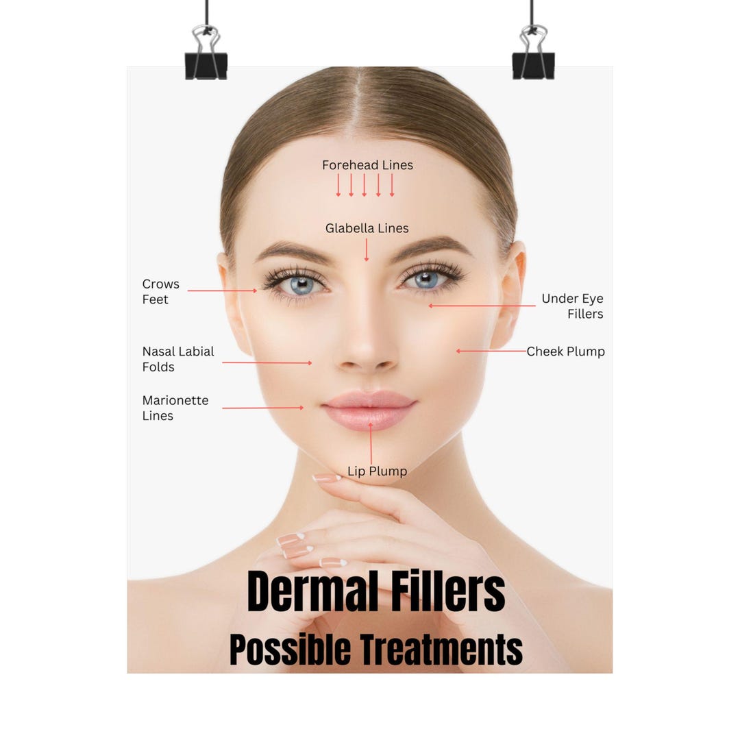 Dermal Fillers Treatment Poster Aesthetic Wall Art, Beauty Education Skincare Decor Cosmetic ...
