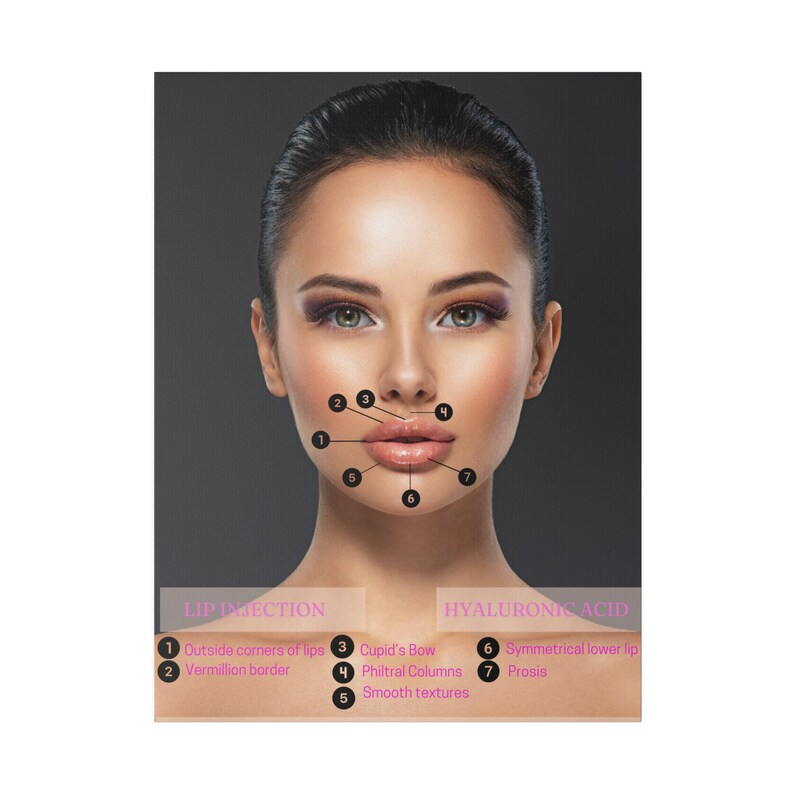 Lip Filler Placements Canva Medspa Decoration, Lip Injections Areas ...