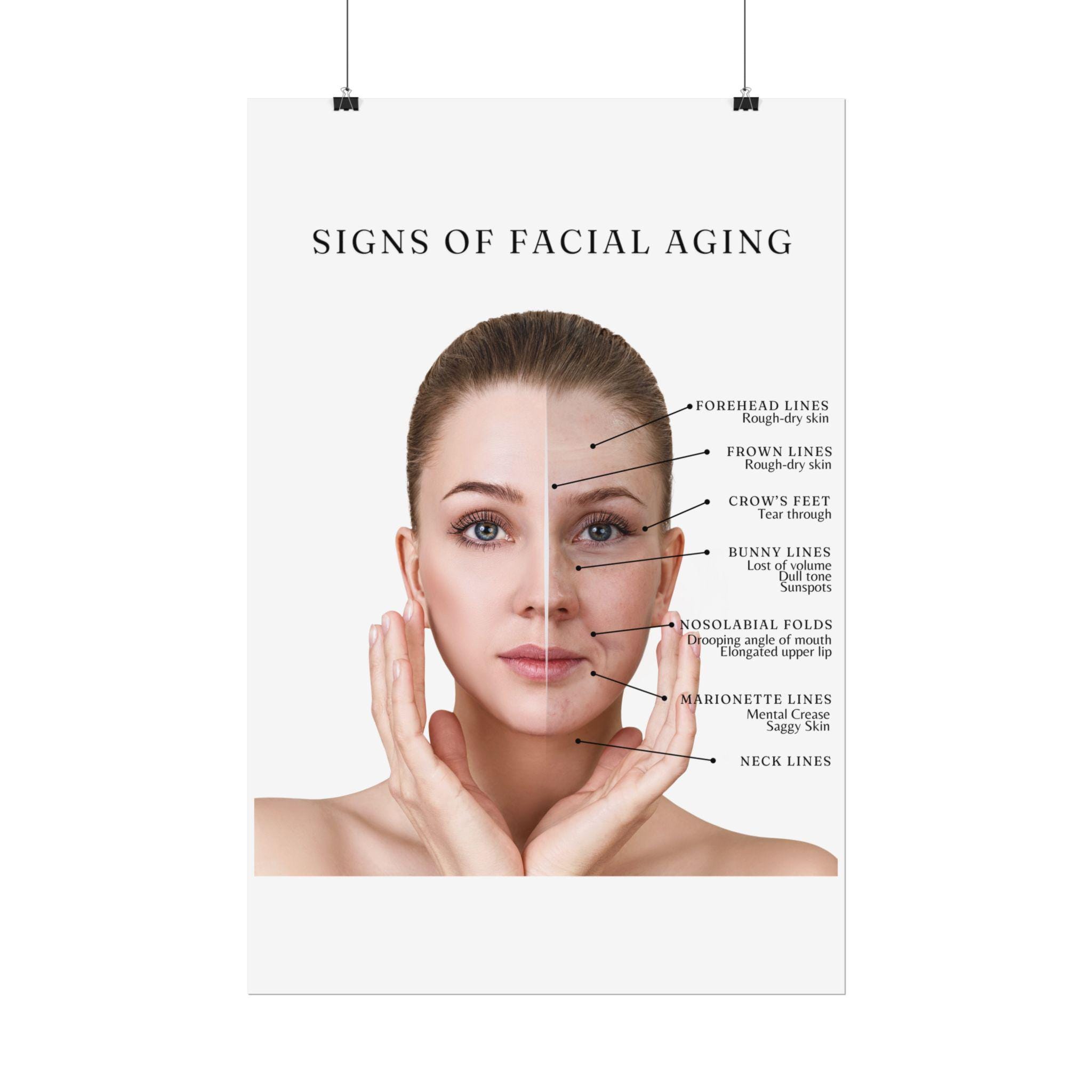 Signs of Facial Aging Rolled Poster, Med Spa Poster, Esthetician Wall ...
