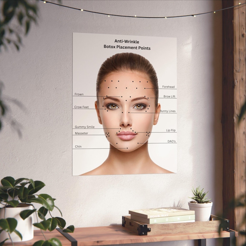 Customized With Logo Anti-wrinkle Botox Placement Points Poster, Medspa ...
