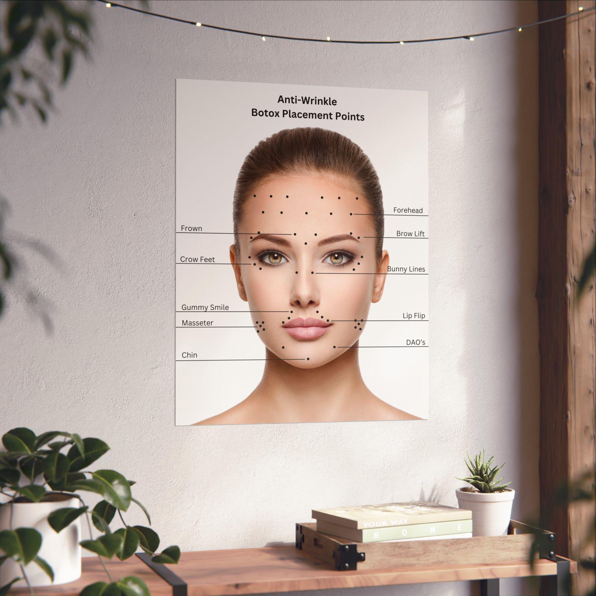 Customized With Logo Anti-wrinkle Botox Placement Points Poster, Medspa ...