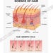 Science of Hair Poster, Hair Growth Stages Medspa Nurse Injector Decor ...