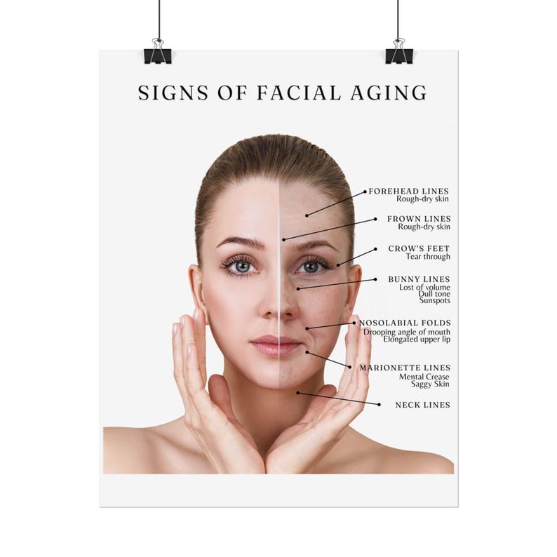 Signs of Facial Aging Rolled Poster, Med Spa Poster, Esthetician Wall ...