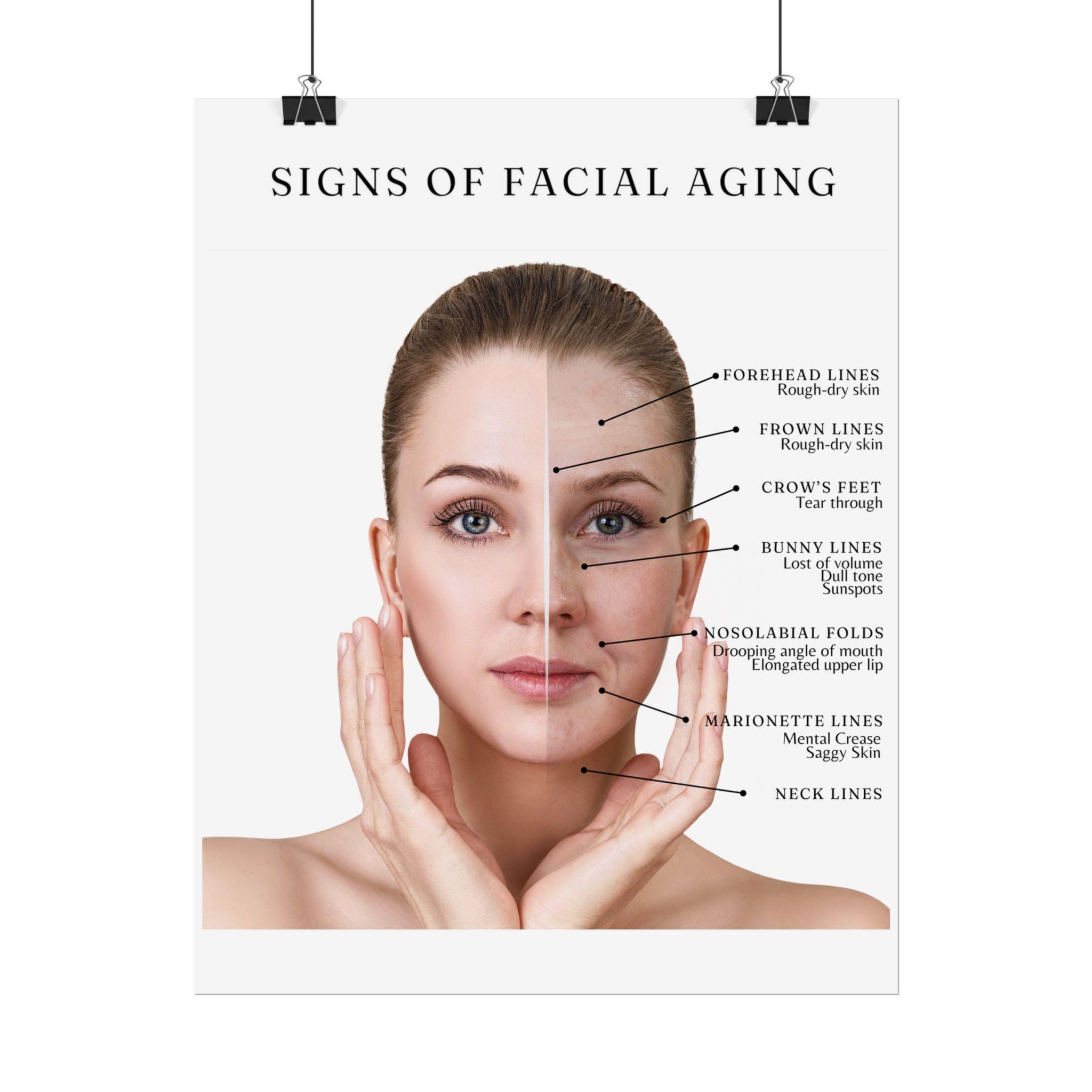 Signs of Facial Aging Rolled Poster, Med Spa Poster, Esthetician Wall ...