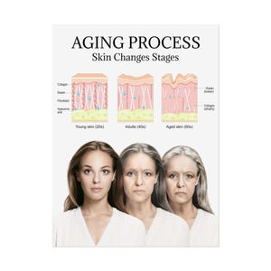 Aging Process Skin Changes Stages Rolled Poster, Face Lift Med Spa ...