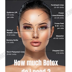 Customizable How Much Botox Do I Need Poster, Esthetician Consultation ...