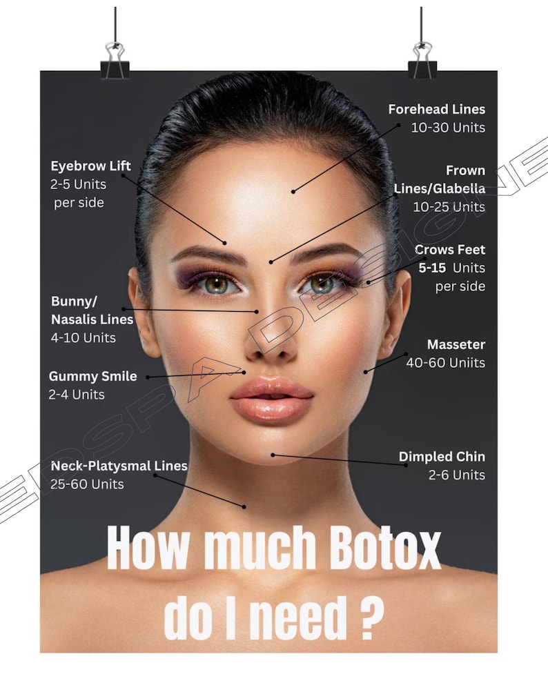 Customizable How Much Botox Do I Need Poster, Esthetician Consultation ...