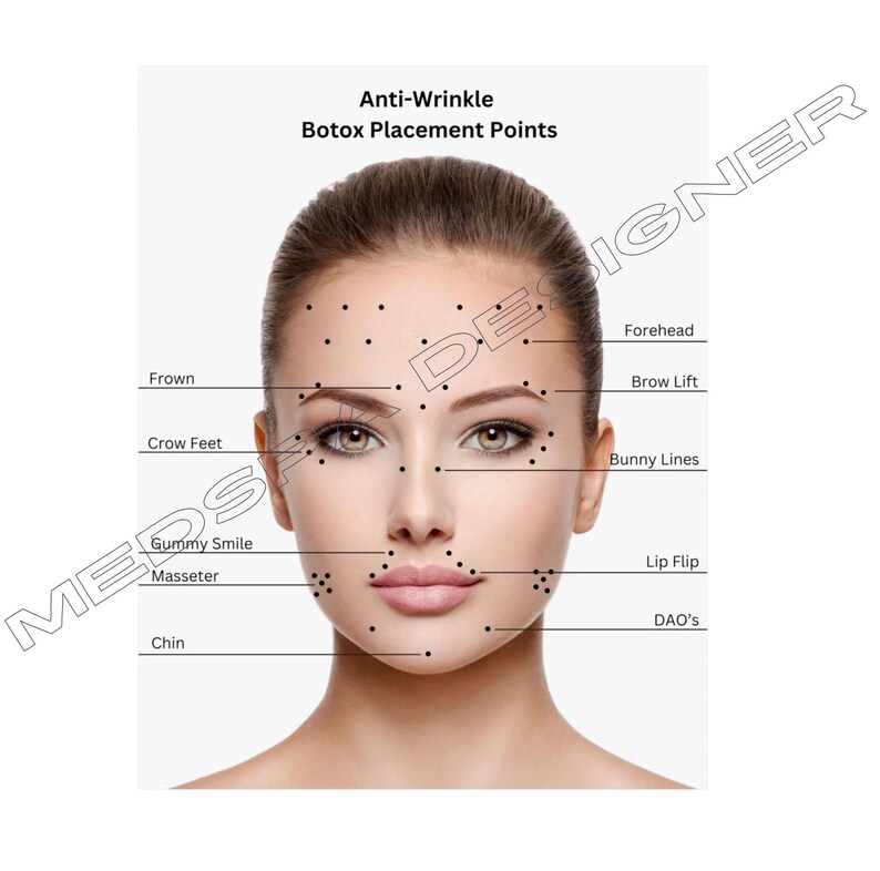 Customized With Logo Anti-wrinkle Botox Placement Points Poster, Medspa ...