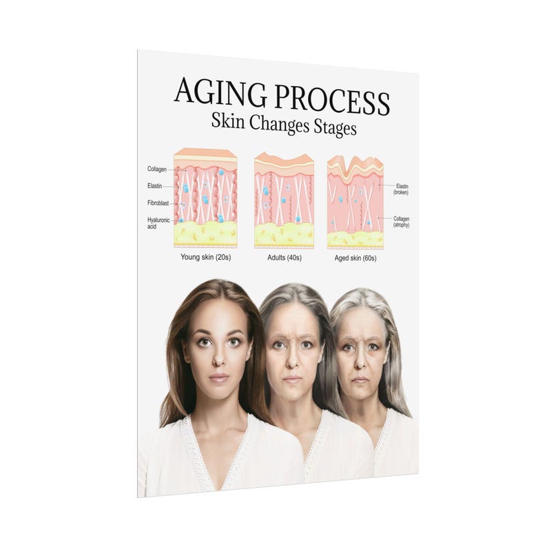 Aging Process Skin Changes Stages Rolled Poster, Face Lift Med Spa ...