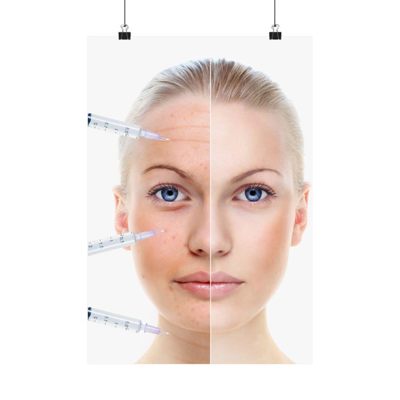 Botox Treatment Before and After Matte Vertical Poster, Medspa Nurse ...