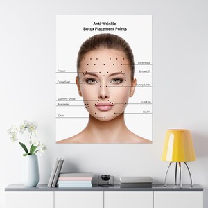 Customized With Logo Anti-wrinkle Botox Placement Points Poster, Medspa ...