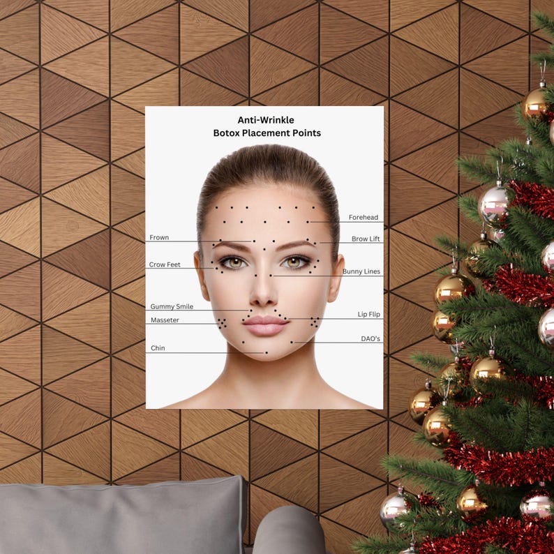 Customized With Logo Anti-wrinkle Botox Placement Points Poster, Medspa ...