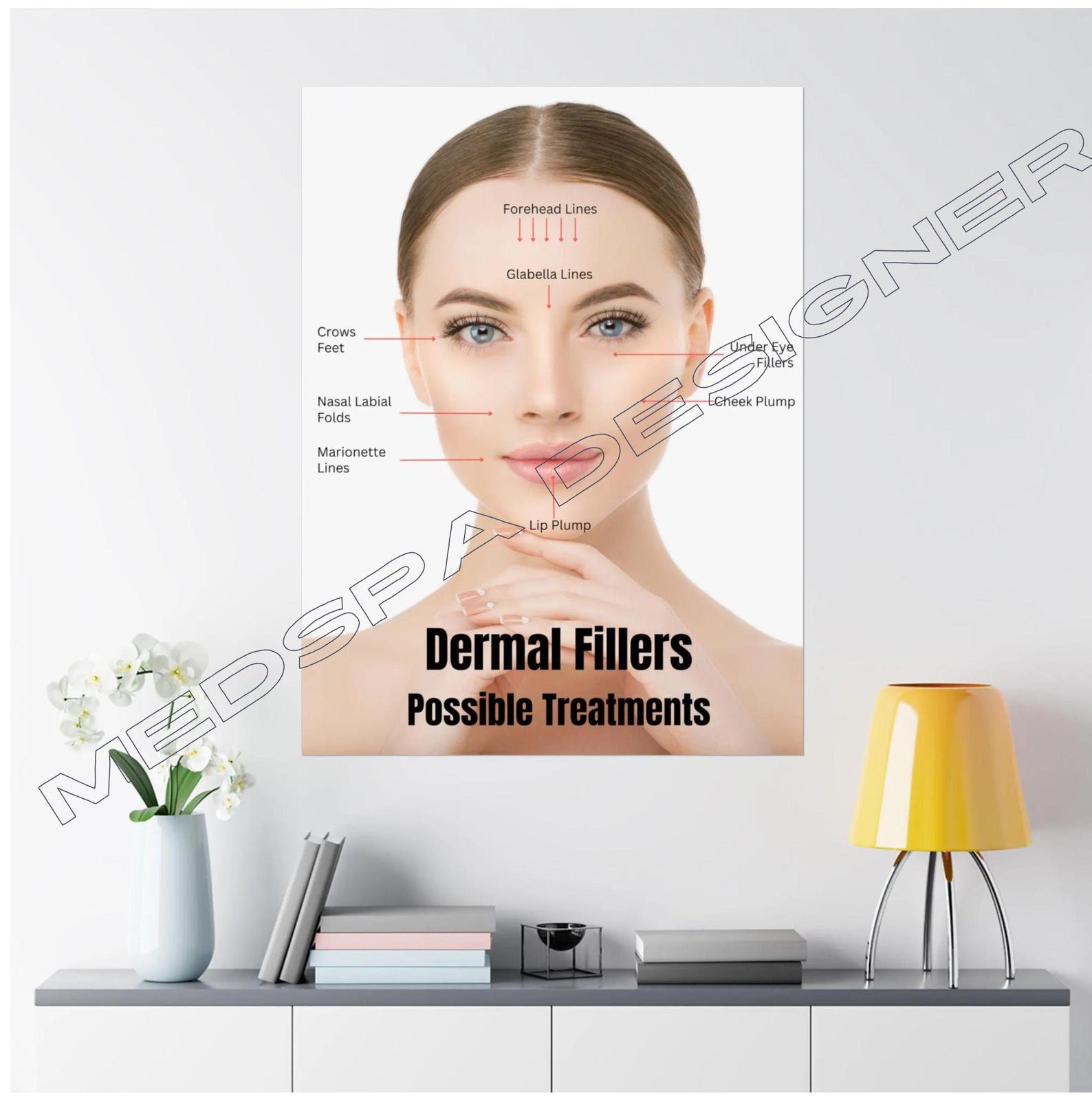 Dermal Filler Possible Treatments Poster, Medspa Nurse Injector Decor ...