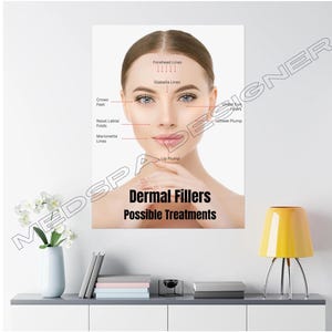Dermal Filler Possible Treatments Poster, Medspa Nurse Injector Decor ...