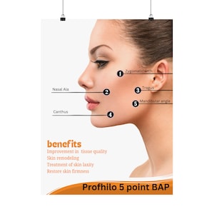 Customized With Logo Profhilo Benefits Esthetician Consultation Tool ...