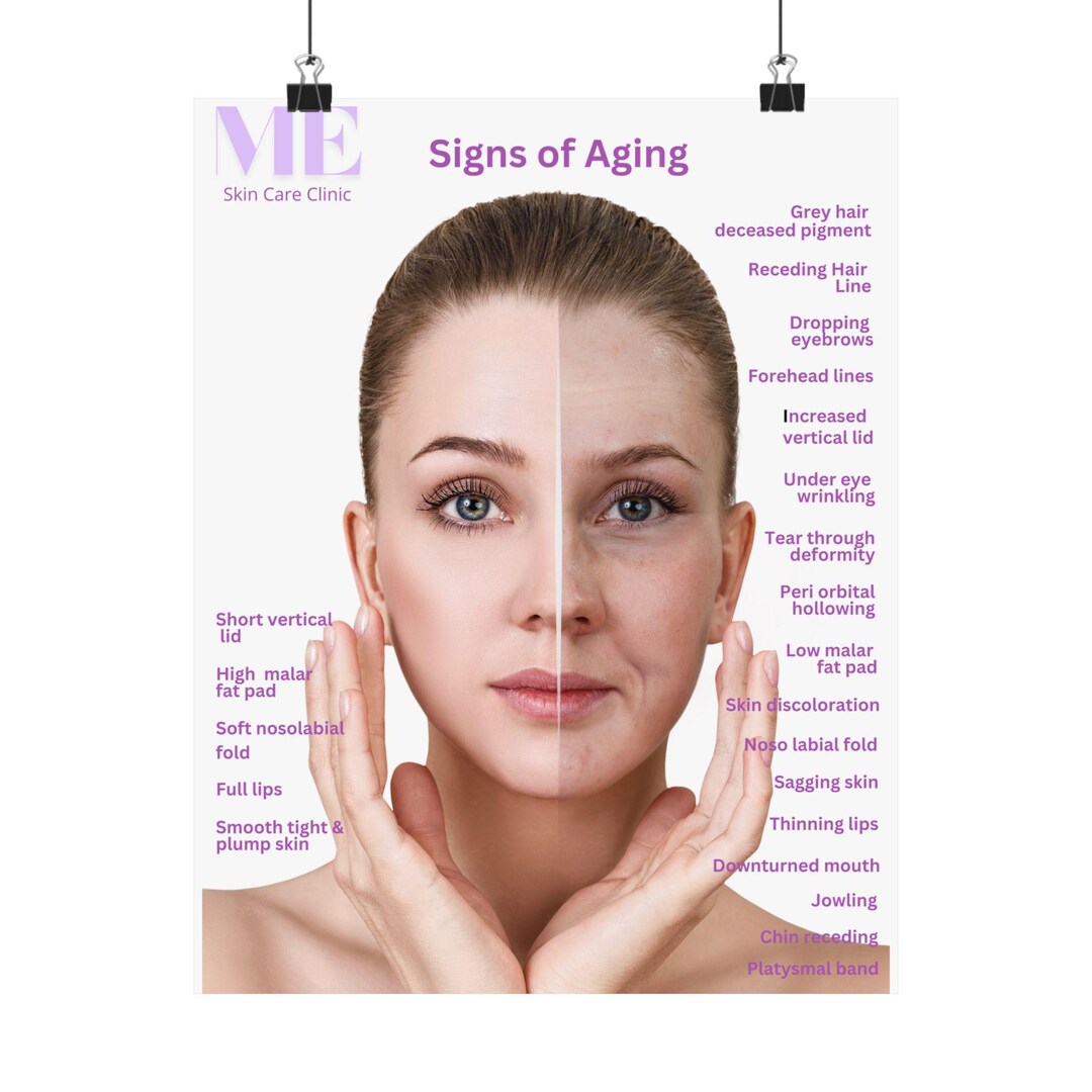 Customized With Logo Signs of Aging Poster, Esthetician Consultation ...