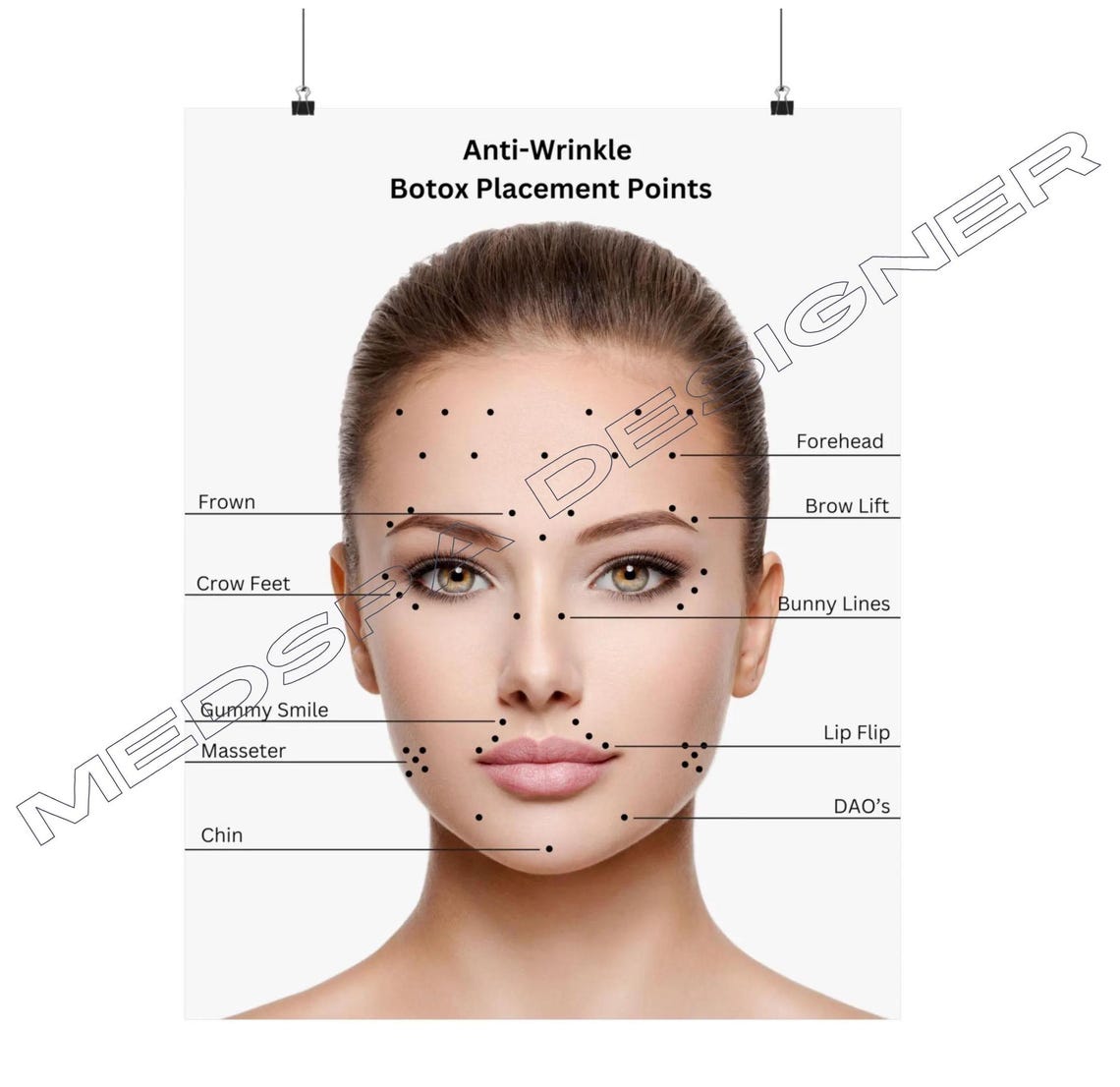 Customized With Logo Anti-wrinkle Botox Placement Points Poster, Medspa ...