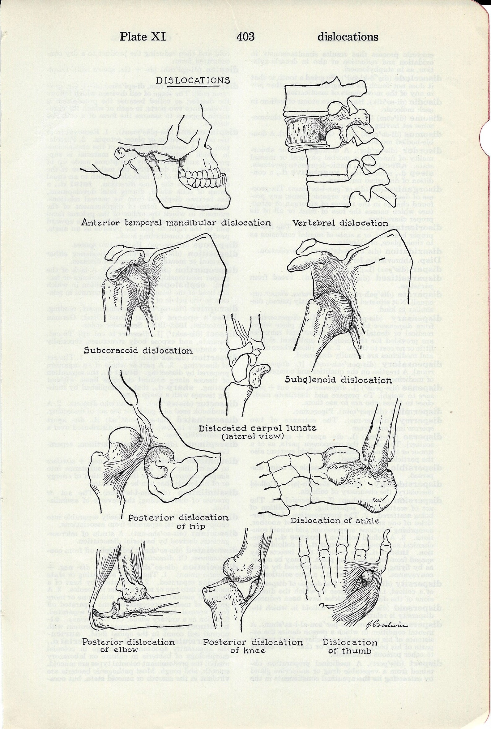 Human Anatomy Dislocation Types Vintage Medical Anatomy | Etsy