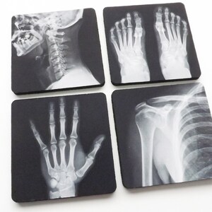 Radiology Coasters Gift Set Medical Anatomy Xray Imaging Doctor Nurse ...