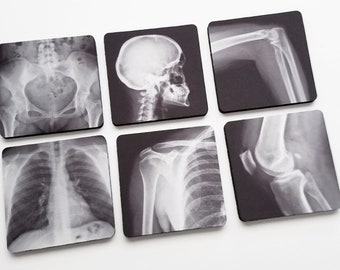 Radiology Coasters Gift Set Medical Anatomy Xray Imaging | Etsy