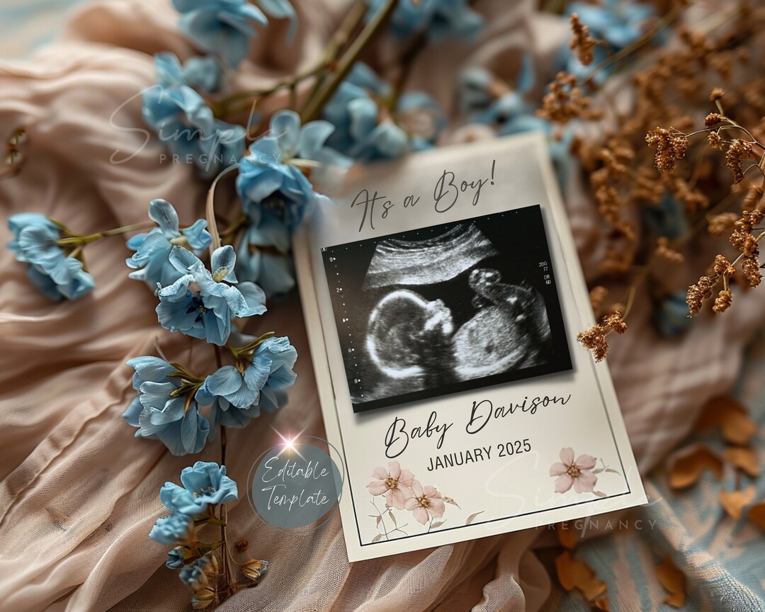 It's a Boy Baby Gender Reveal, Simple Spring Minimalist Social Media Announcement, Editable ...