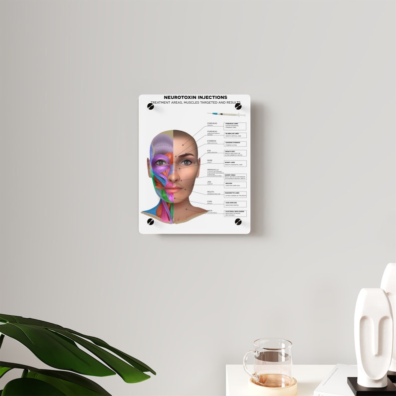 Neurotoxin Injections Placement Areas Acrylic Wall Art Panel, Nurse ...