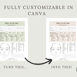 Editable Facial Skin Analysis Form, Esthetician Forms Face Mapping ...