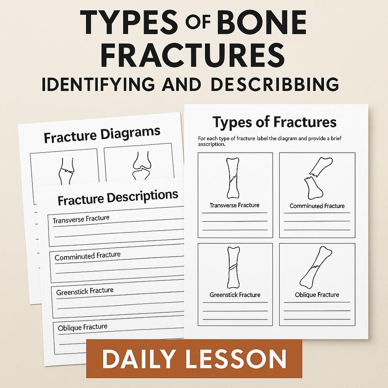 Types of Bone Fractures: Identifying and Describing | Daily Lesson ...