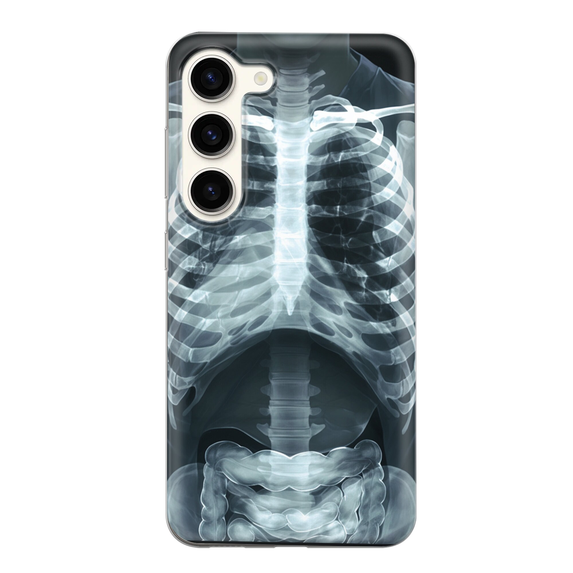Medical Equipment Phone Case Anatomy Students Gift Cover for Samsung ...