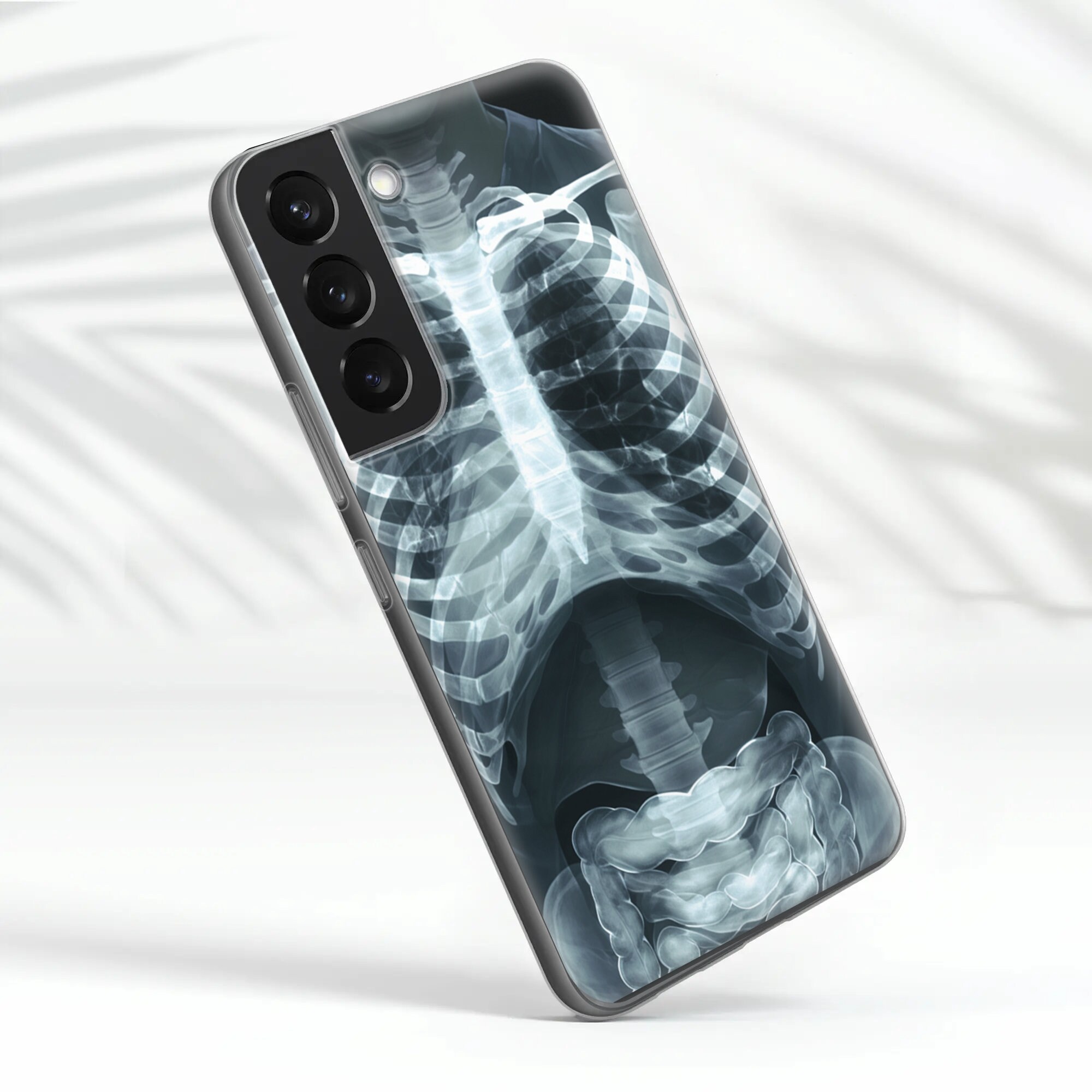 Medical Equipment Phone Case Anatomy Students Gift Cover for Samsung ...