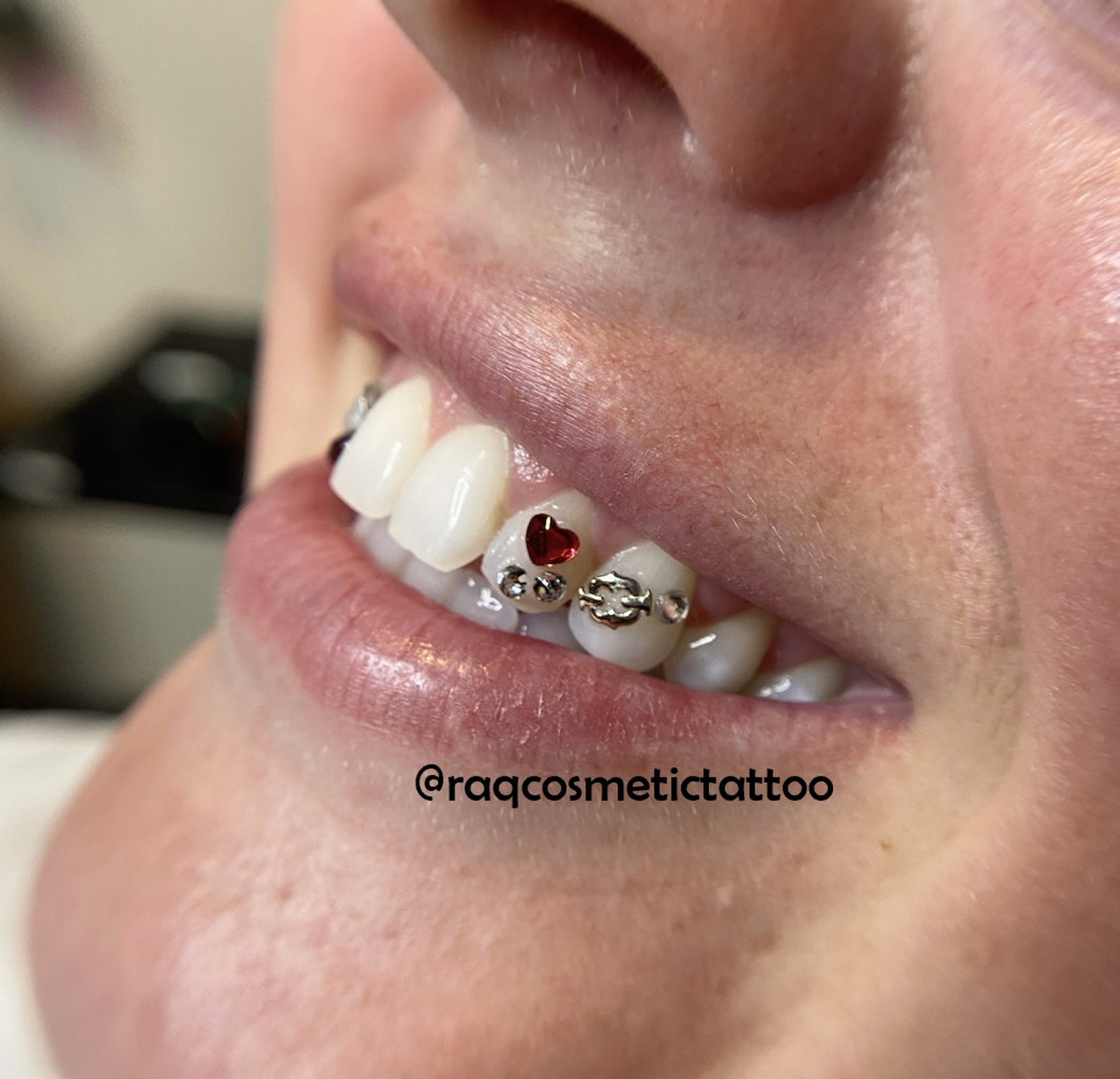 Chain Link 18k Gold Tooth Charm - Etsy