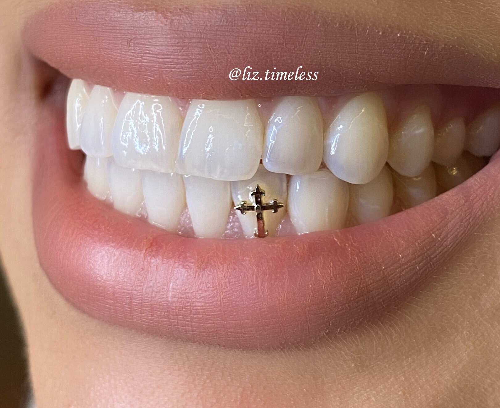 Trinity Cross 18k Gold Tooth Charm - Etsy