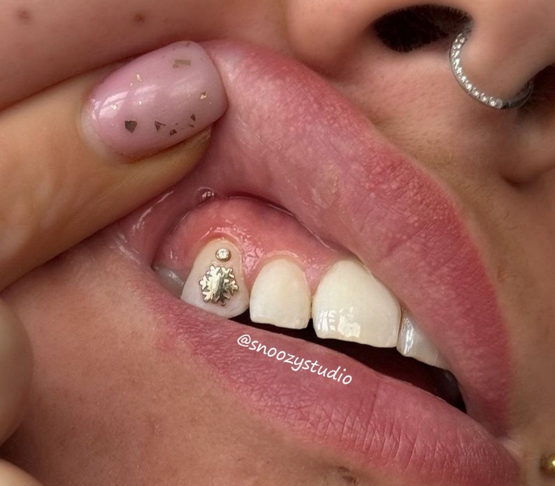 Snowflake 18k Gold Tooth Charm - Etsy